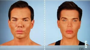 19 Disturbing Times People Took Plastic Surgery Too Far