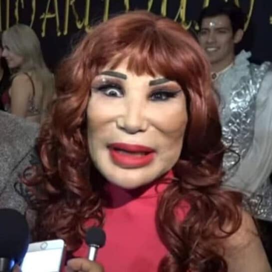 19 Disturbing Times People Took Plastic Surgery Too Far
