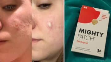 Here Are 33 Things To Help Solve Those Annoying Body Issues You’ve ...